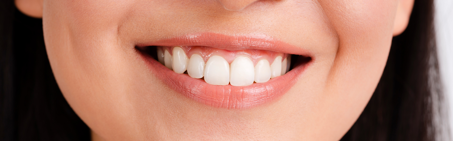 Straight Teeth Made Simple: Braces-Free Solutions for Crooked Smiles